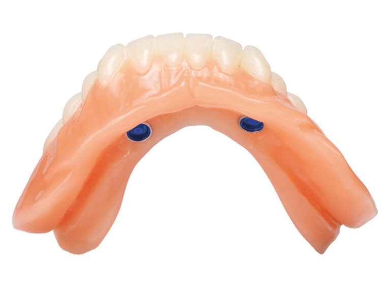 EVO Fusion Dentures - SCD