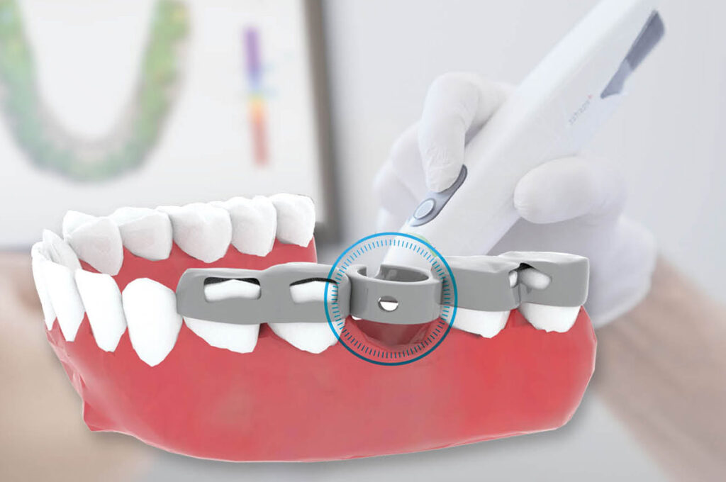 Metal Surgical Guide - SCD